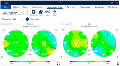 Passive Microwave Radiometry And Microrna Detection For Breast Cancer Diagnostics