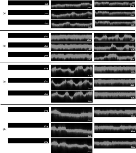 Clsm Optical Cross Sectional X Z Images Were Obtained Following 1 H