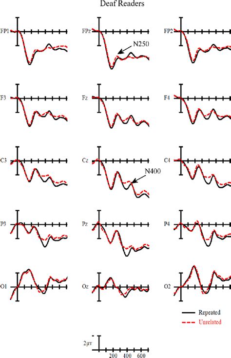 Grand Average Erps From 15 Analysis Electrodes Time Locked To Target