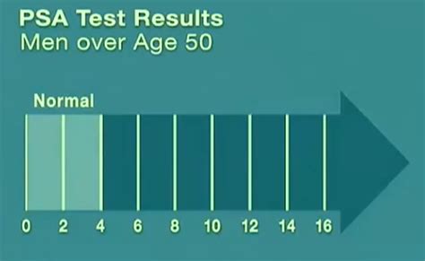 Psa Test Results Chart A Visual Reference Of Charts Chart Master
