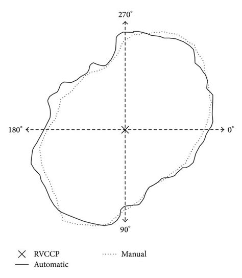 An Example Of Manual To Automatic Contour Extraction A And The
