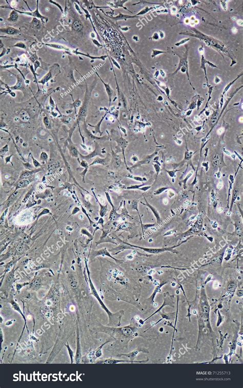 Microscope View Of Muscle Cells Fibroblasts And Myoblasts In Tissue Culture Showing Walls