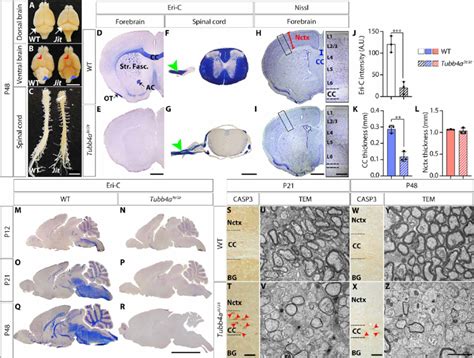 Jittering Tubb4a Jitjit Mutants Display Cns White Matter Defects