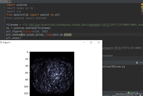 Python3实现对dicom图像处理（图像呈现，缩放，平移）pydicom Scaleup Csdn博客