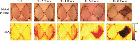 Diffuse Optical Imaging Using Spatially And Temporally Modulated Light
