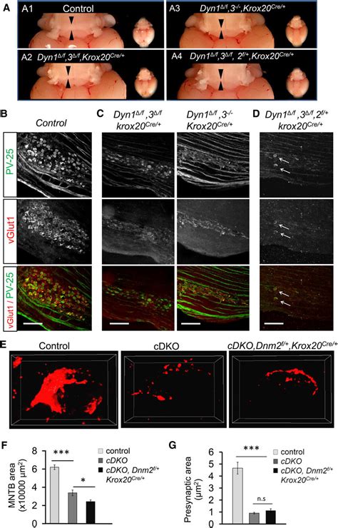 Different Combinations Of Tissue Specific Gene Deletions In Dynamin