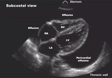 Cardiothoracic Imaging Flashcards Quizlet