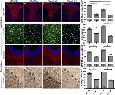Xy Sex Chromosome Complement Compared With Xx In The Cns Confers Greater Neurodegeneration