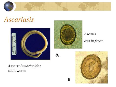 Ppt Parasitological Diseases Of The Human Systems Powerpoint