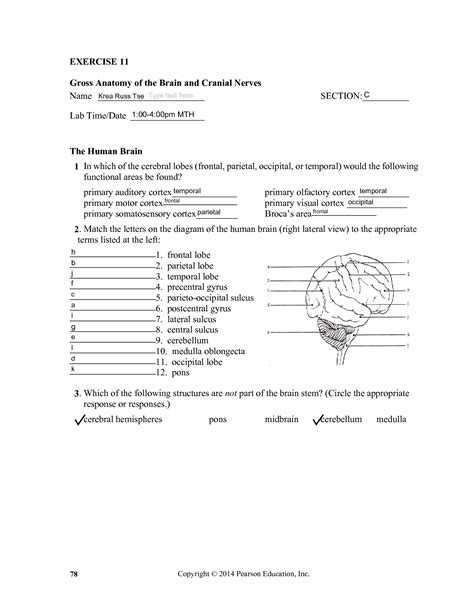 Laboratory Exercise Brain And Cranial Nerves At Joseph Becher Blog