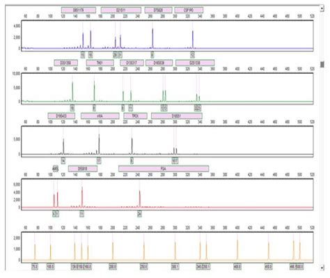 Electropherogram Showing Results Of Str Typing Download Scientific