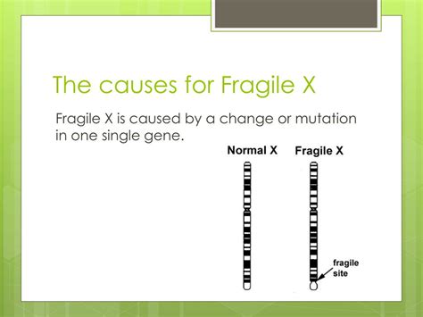 PPT Fragile X Syndrome PowerPoint Presentation Free Download ID 4687888