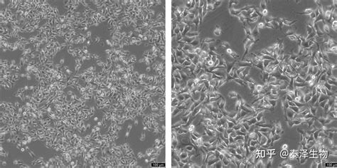 【细胞小讲堂】b16—小鼠黑色素瘤细胞的全面剖析 了解 B16 黑色素瘤细胞如何增进我们对皮肤癌的了解[特点、应用、培养方法与研究进展] 知乎
