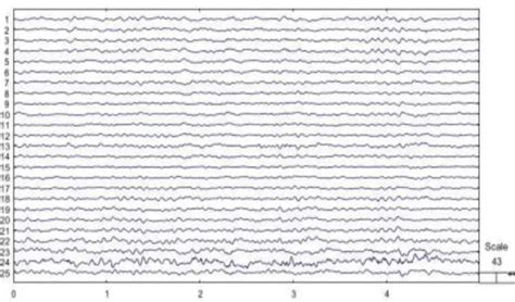 Depicts The Topo Plots Obtained After Extracting 48 Segments Of The