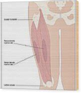 Vastus Lateralis Injection Site Artwork 1 Photograph By Clinical