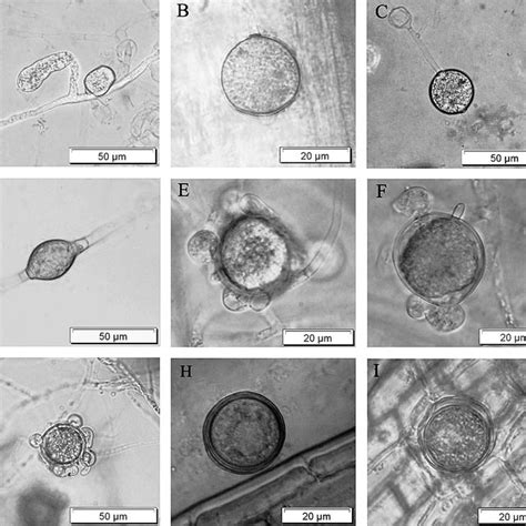 Phylogenetic Relationships Between Pythium And Phytophthora Spp