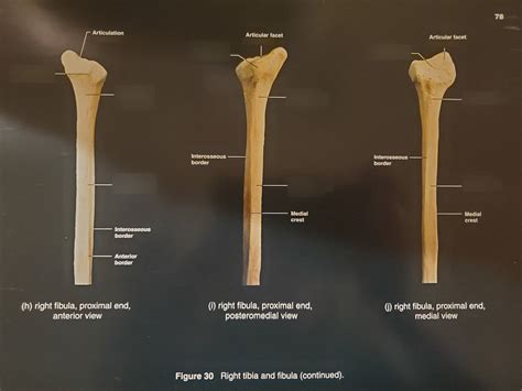 Right Fibula Proximal End Diagram Quizlet