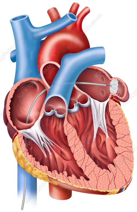 Left Atrial Appendage Illustration Stock Image F045 7700 Science