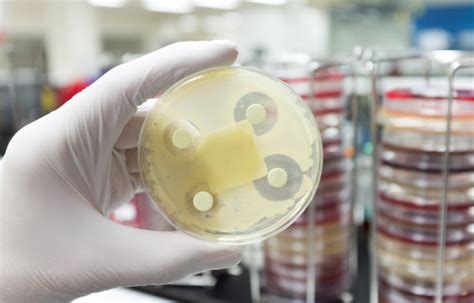 Difference Between Mrsa And Mssa Difference Between Mrsa Vs Mssa