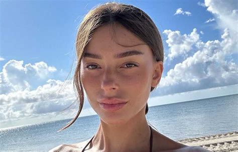 דיאן שוורץ המומה ההפרעה הנפשית שממנה היא סובלת נחשפת שמועה בידור