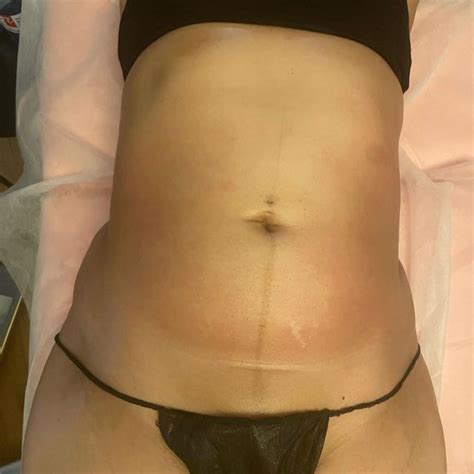 Contouring On Tumblr