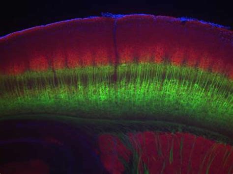Selecting Between Sensations Neuroscience News