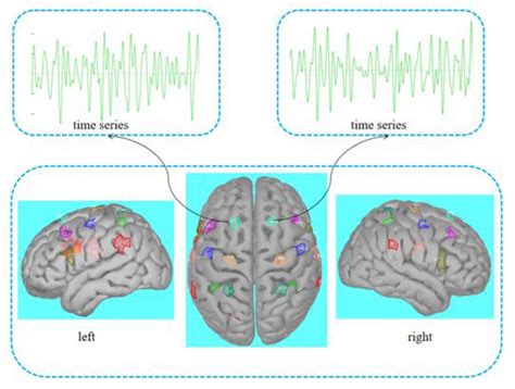 A Combined Virtual Electrode Based Esa And Cnn Method For Mi Eeg Signal