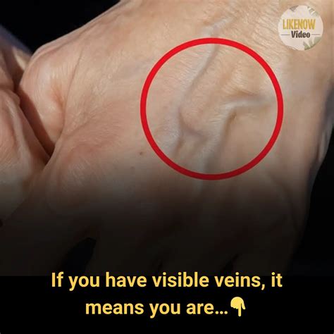 If You Have Visible Veins It Means You Are