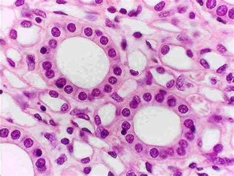 Simple Cuboidal Epithelium Under Microscope X Micropedia My Xxx Hot Girl
