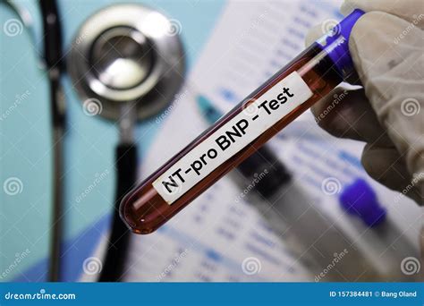 NT Pro BNP Test With Blood Sample Top View Isolated On Office Desk Stock Image Image Of