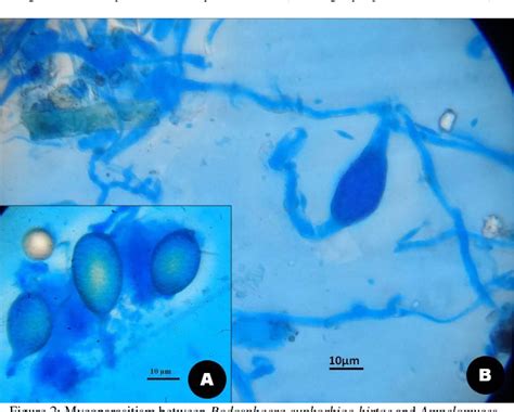Figure 2 From Ampelomyces Quisqualis Ces A Mycoparasite Of Euphorbia