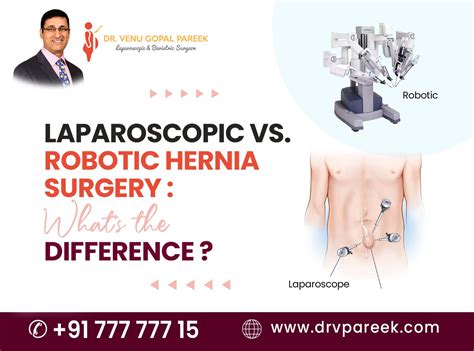 Laparoscopic Vs Robotic Hernia Surgery Whats The Difference Bariatric Surgeon India