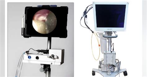 Endoscope Device Classification At Willie Poole Blog