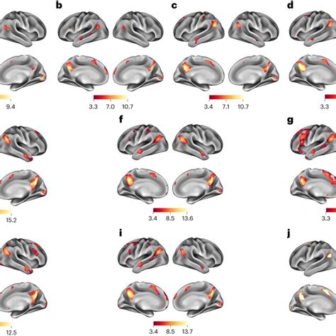 results of whole brain univariate analyses a i statistical parametric