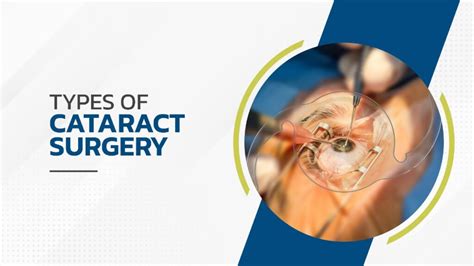 Types Of Cataract You Should Know Before Surgery
