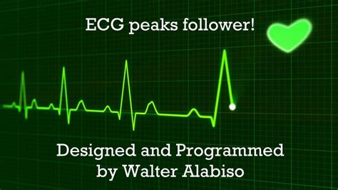 Ecg Peak Detector Matlabarduino Project Eng Youtube