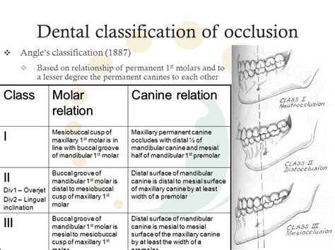 Dental Occlusion Classification At Antonio Baker Blog