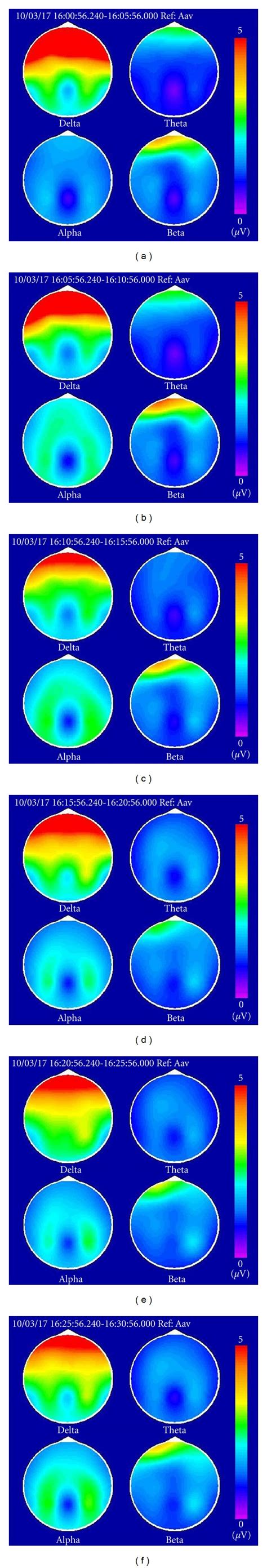 Af The Power Spectrum Maps Of Eeg In The Six Sessions Of One
