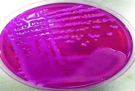 Colonies Staphylococcus Haemolyticus On The Macconkey Agar Medium The Download Scientific