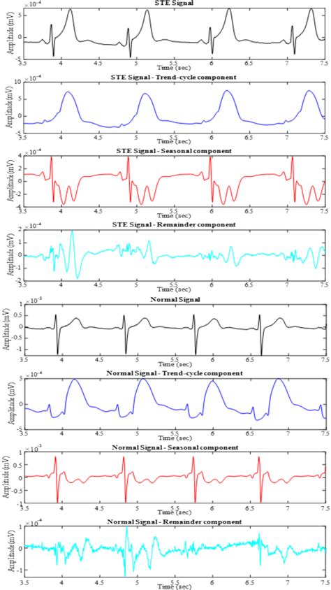 Decomposition Of The Signals Into Three Components The Trend Cycle