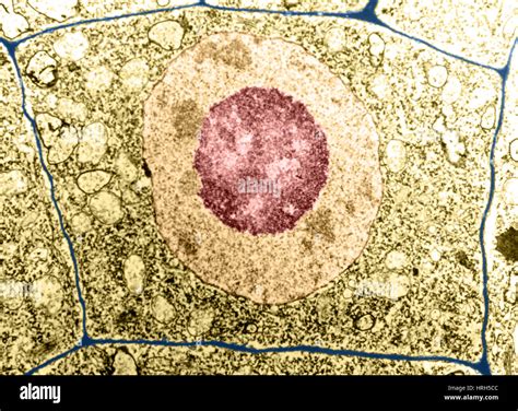 Nucleolus Micrograph