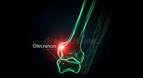 Human Elbow Anatomy Olecranon Process 3d Medical Illustration Showing Bone Structure And