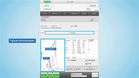 D 100 Hemoglobin Testing Solution Bio Rad