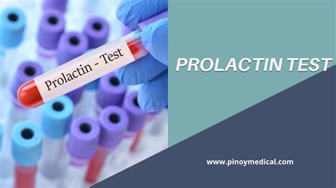 Prolactin Test Price In The Philippines 2025 — Pinoymedical