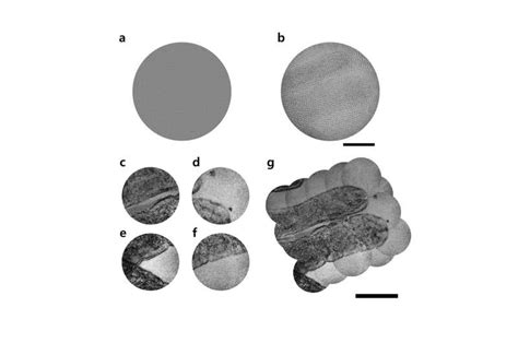 The Invention Of A Flexible Endoscope Thinner Than A Needle