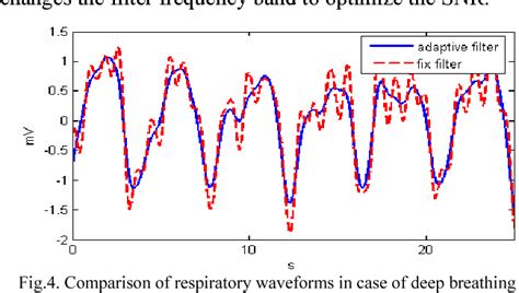 Figure 1 From Estimation Of Respiratory Waveform And Heart Rate Using