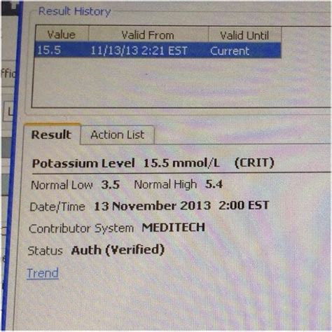 Pseudohyperkalemia Precious Bodily Fluids