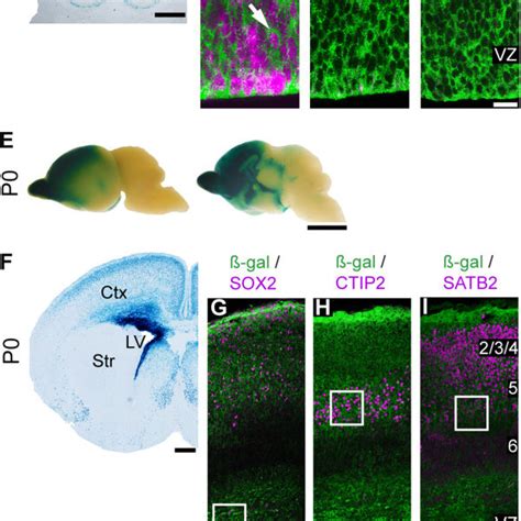 Promoter Activity Of The 2 7 Kb Fragment During Cortical Development Download Scientific