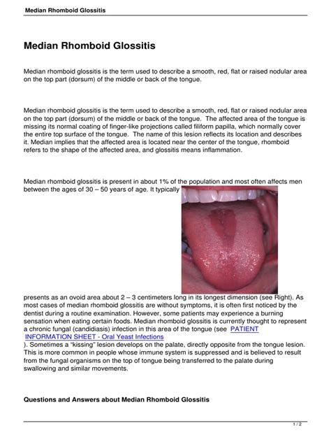Median Rhomboid Glossitis Kissing Lesion