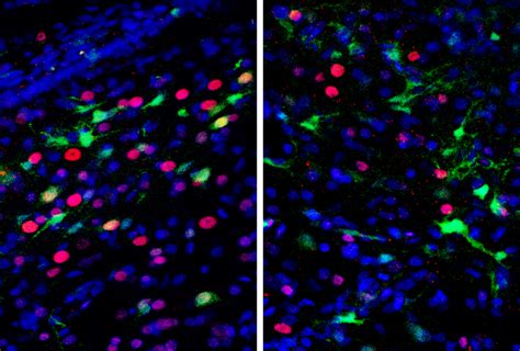 Lacking Autism Linked Gene Female Birds Tune Out Favorite Songs The